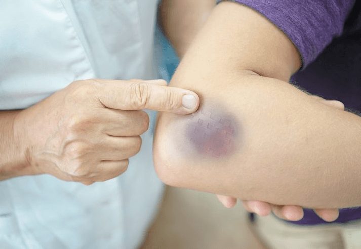 4 Manfaat Daun Kemuning untuk Kesehatan dan Kecantikan | Mumtaz Herbal